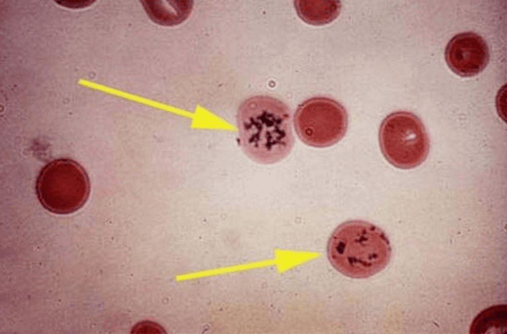 5 lưu ý nhuộm hồng cầu lưới máu ngoại vi đẹp, rõ ràng - Vinatac