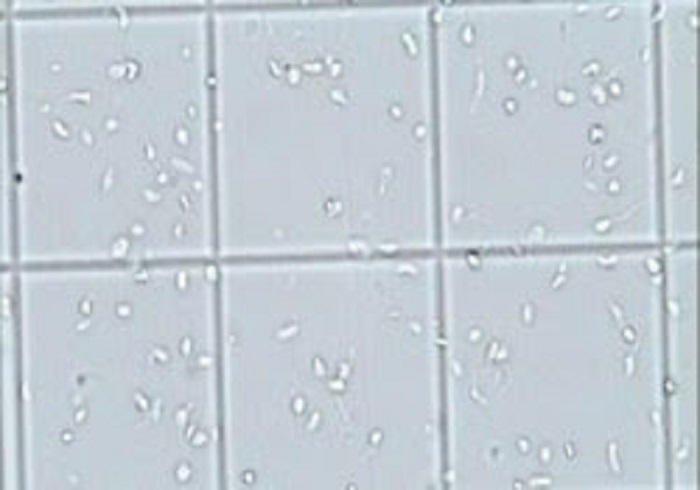 5 lưu ý giúp đếm tiểu cầu thủ công chính xác - Vinatac